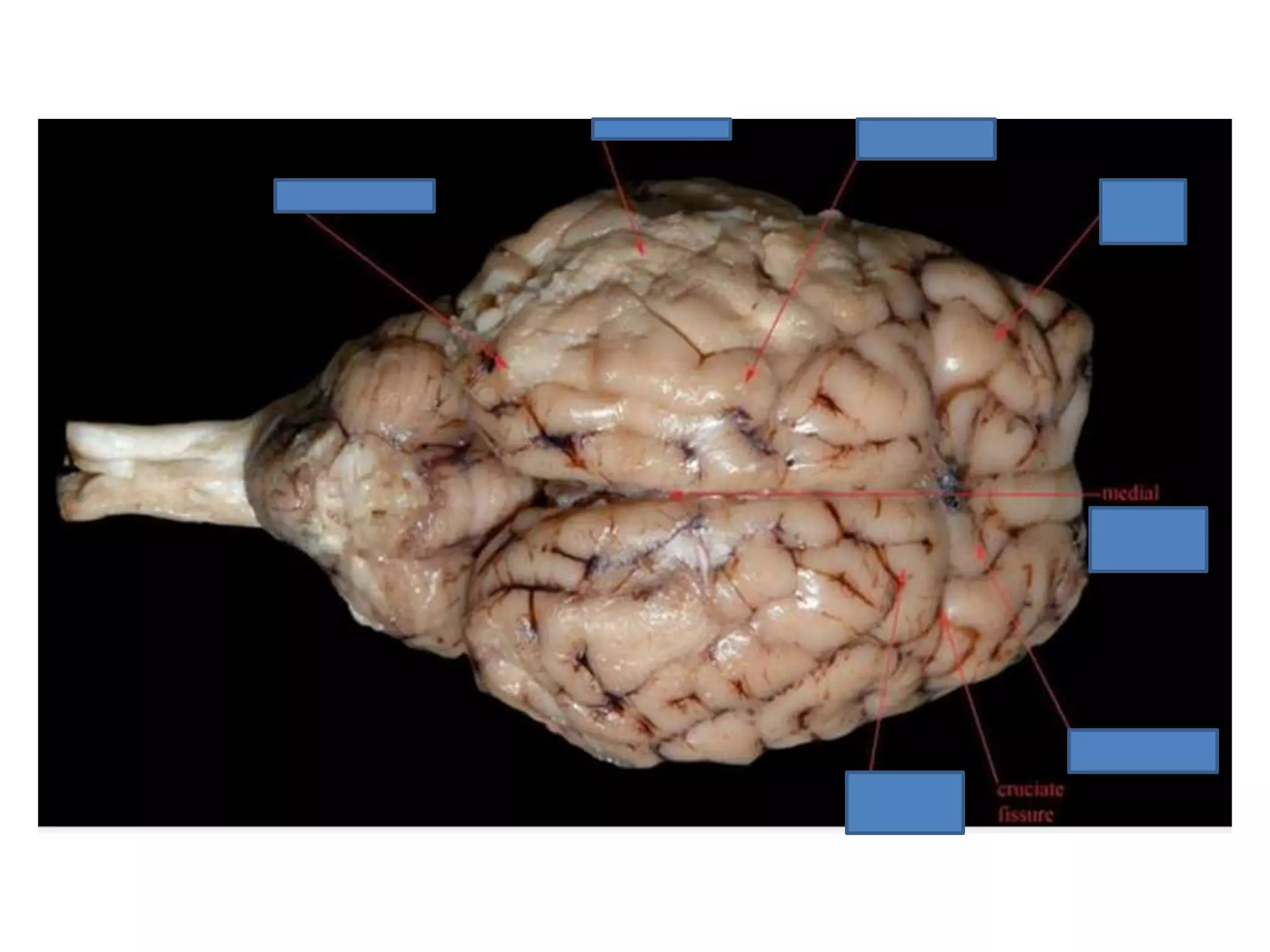 Brain and cranial nerves and Spinal cord and Spinal Nerves | PPT