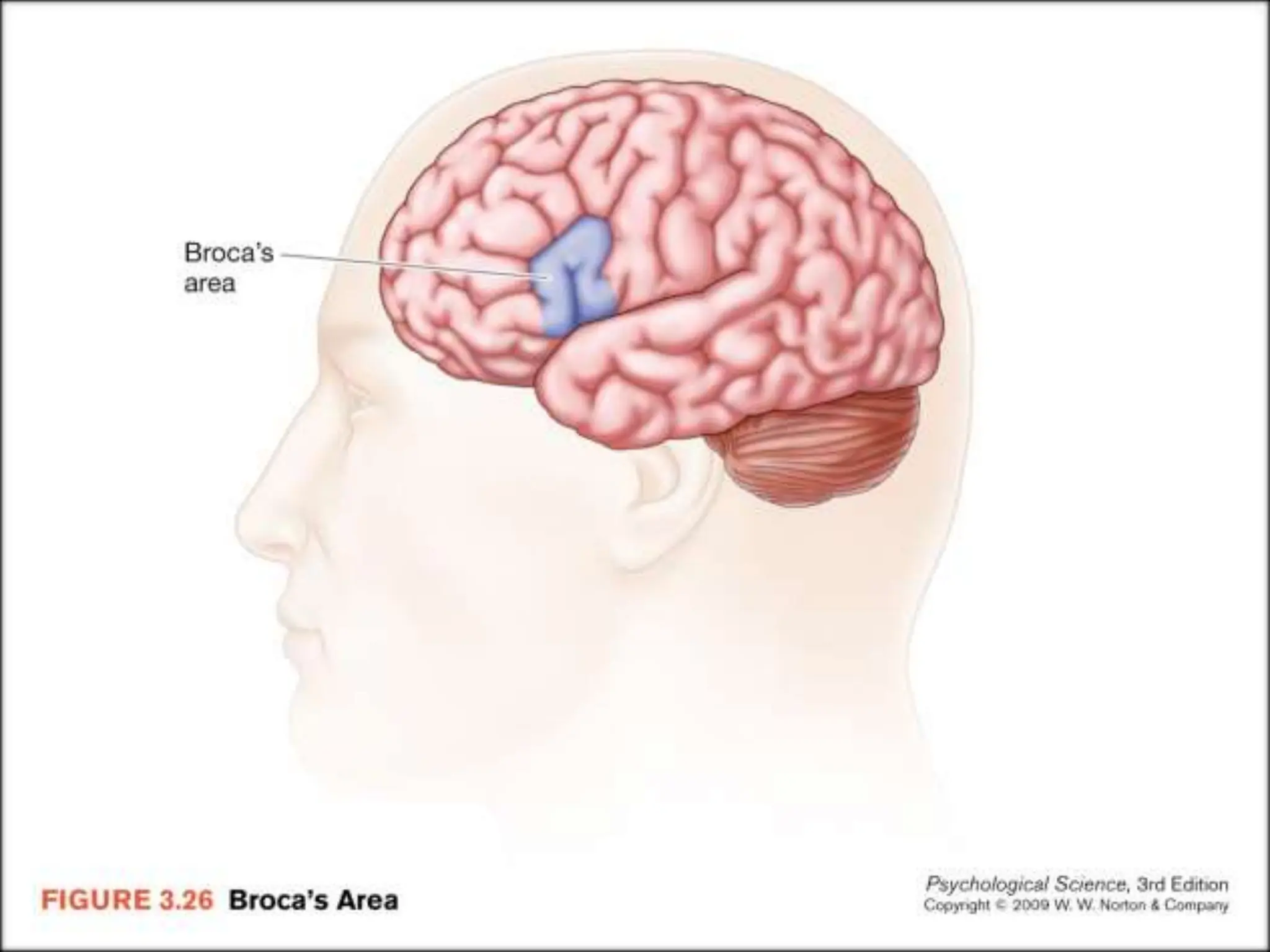 Brain and Language final 1 ggghhhhh.pptx | Brain and Nervous System Disorders | Diseases and ...