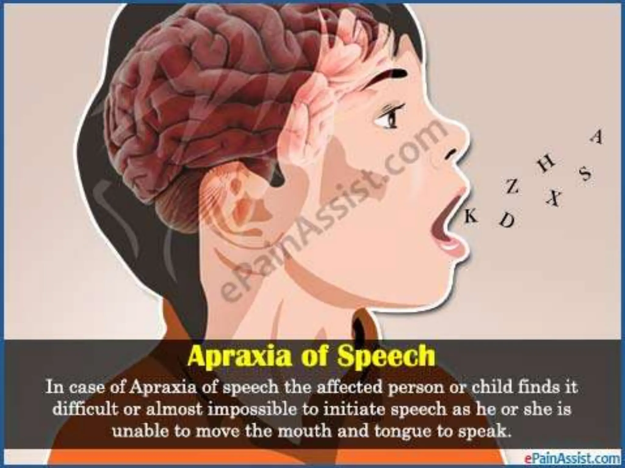 Brain and Language final 1 ggghhhhh.pptx | Brain and Nervous System ...