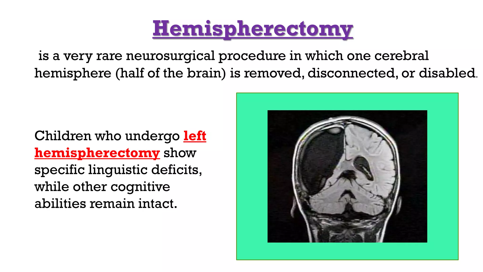 Brain and language | PDF