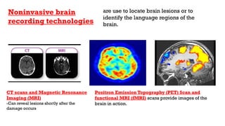 Brain and language | PDF