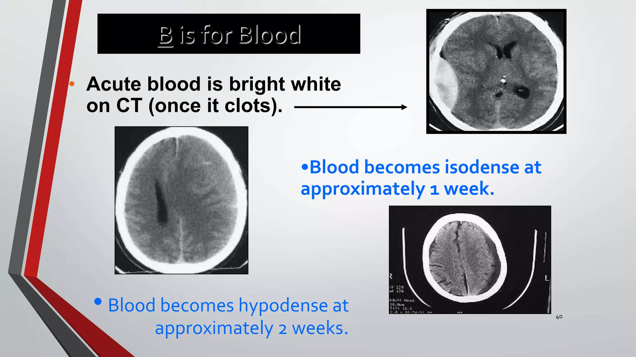 Brain and PNS CT Scan techniques | PPTX
