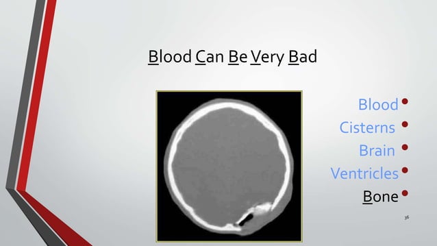 Brain and PNS CT Scan techniques | PPTX