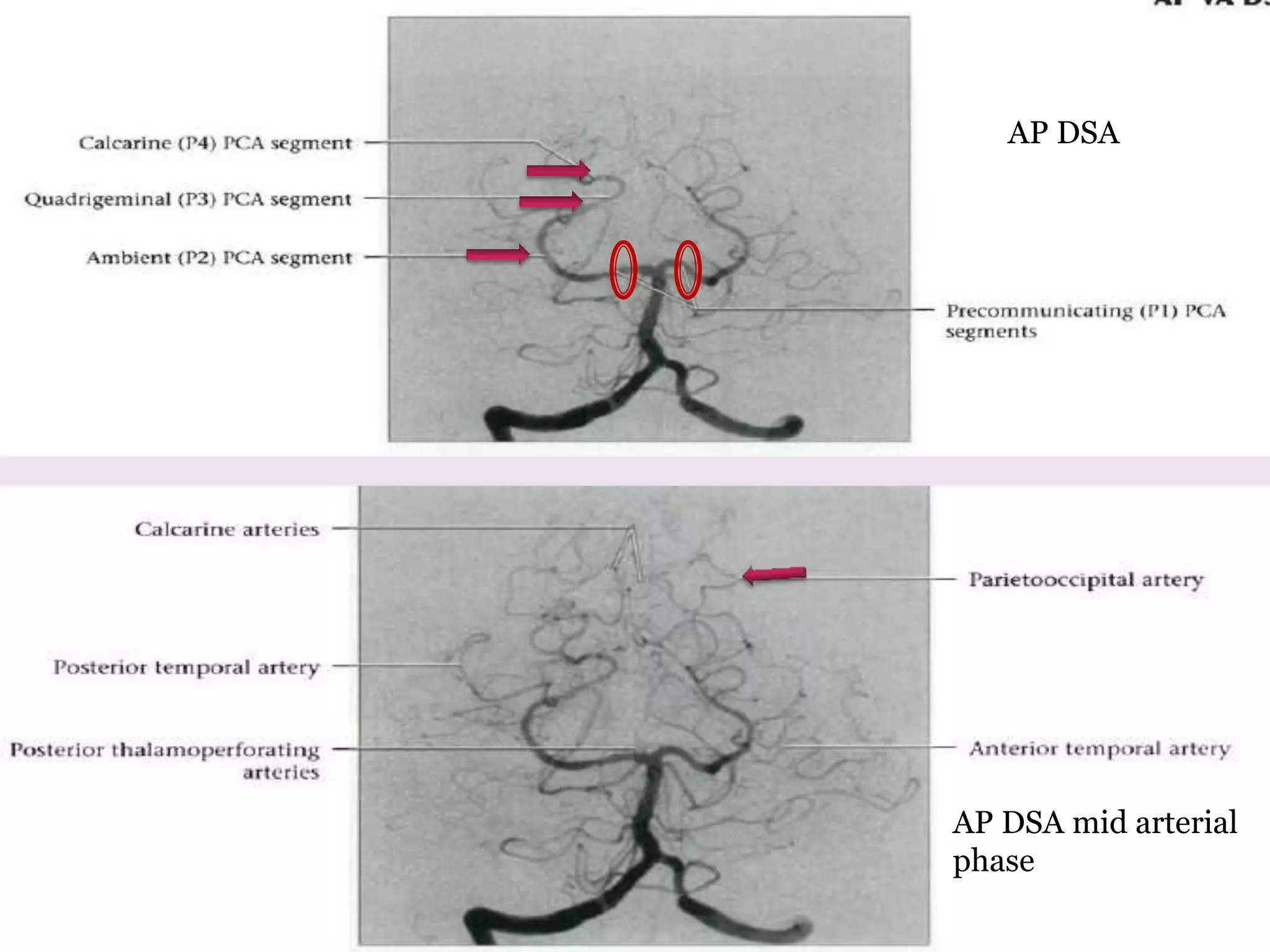 brain arterial anatomy 2vish.pptx