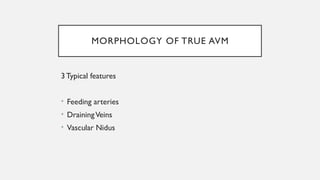 Arterio Venous Malformations of Brain.pptx