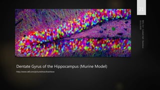Brainbow - Combinatorial Fluorescent Protein Techniques to Map The ...