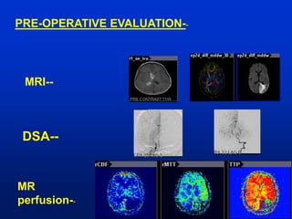 Brain bypass | PPT