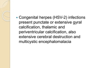 intracerebral calcification | PPTX | Brain and Nervous System Disorders ...