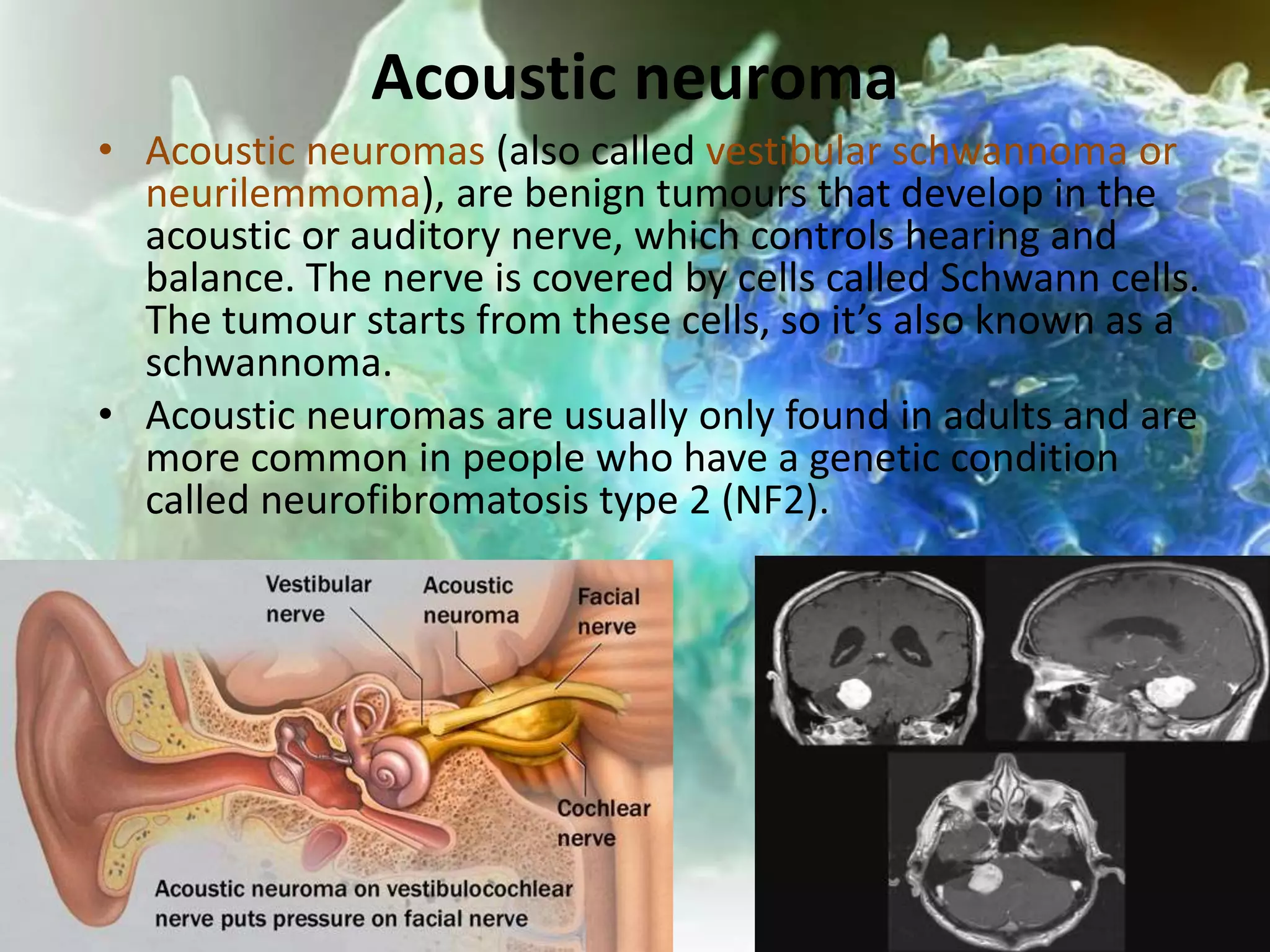 Brain cancer (tumors) | PPTX