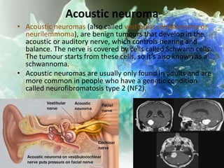 Brain cancer (tumors) | PPTX