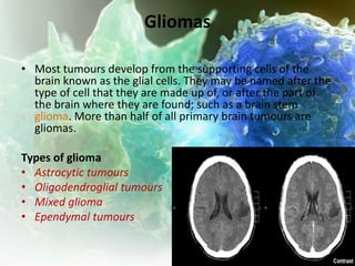 Brain cancer (tumors) | PPTX