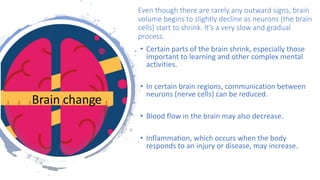 Brain check | PPT