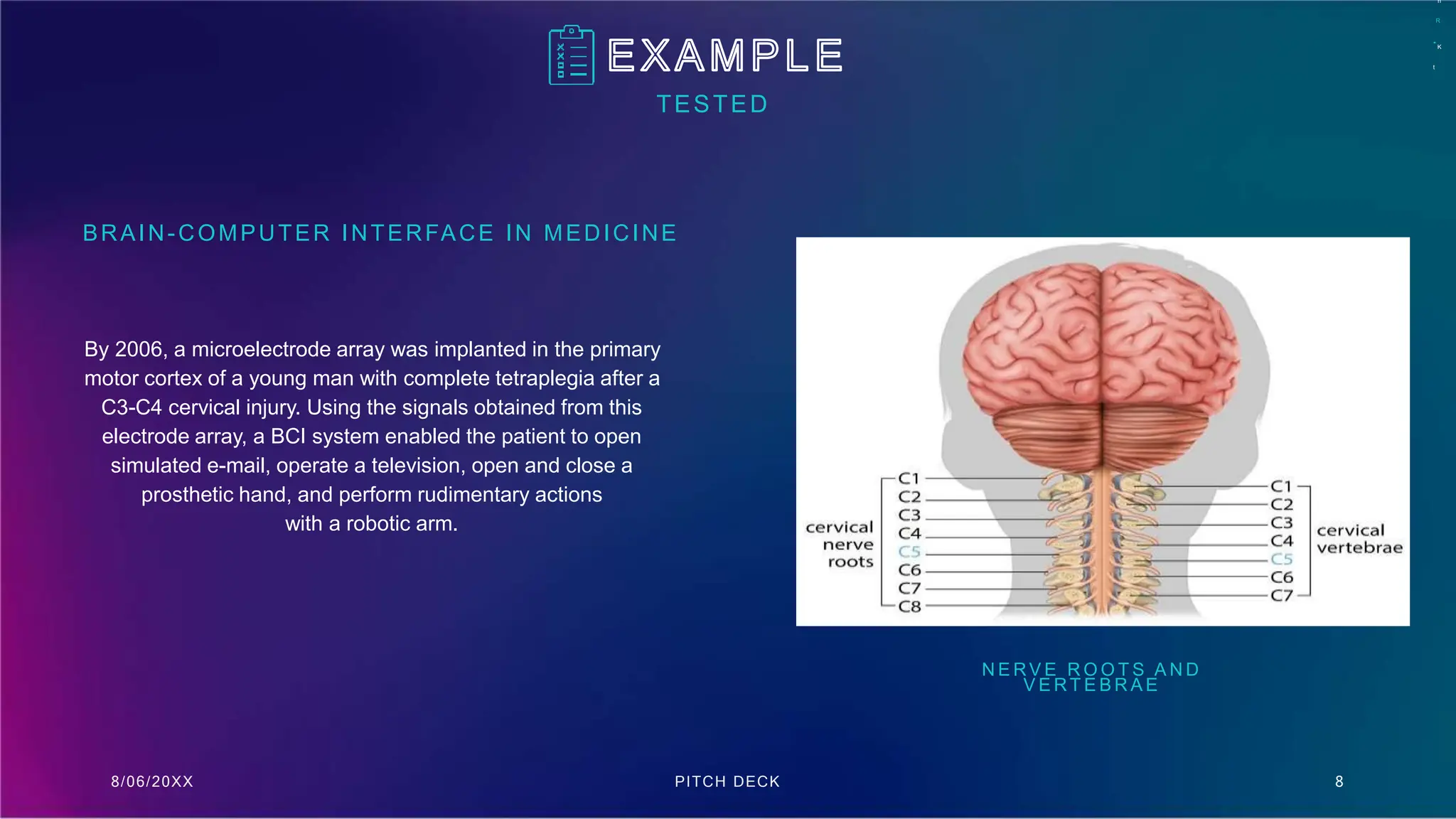 brain chip.pptx jfjffjfjfjfjfjfjffjfjfjfjfjf | PPTX