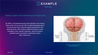 brain chip.pptx jfjffjfjfjfjfjfjffjfjfjfjfjf | PPT