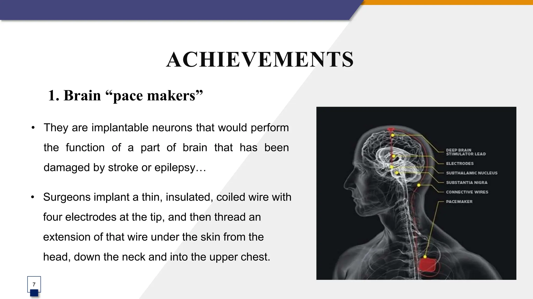 BrainChip_PPT shree utar gujrat cllllage.pptx