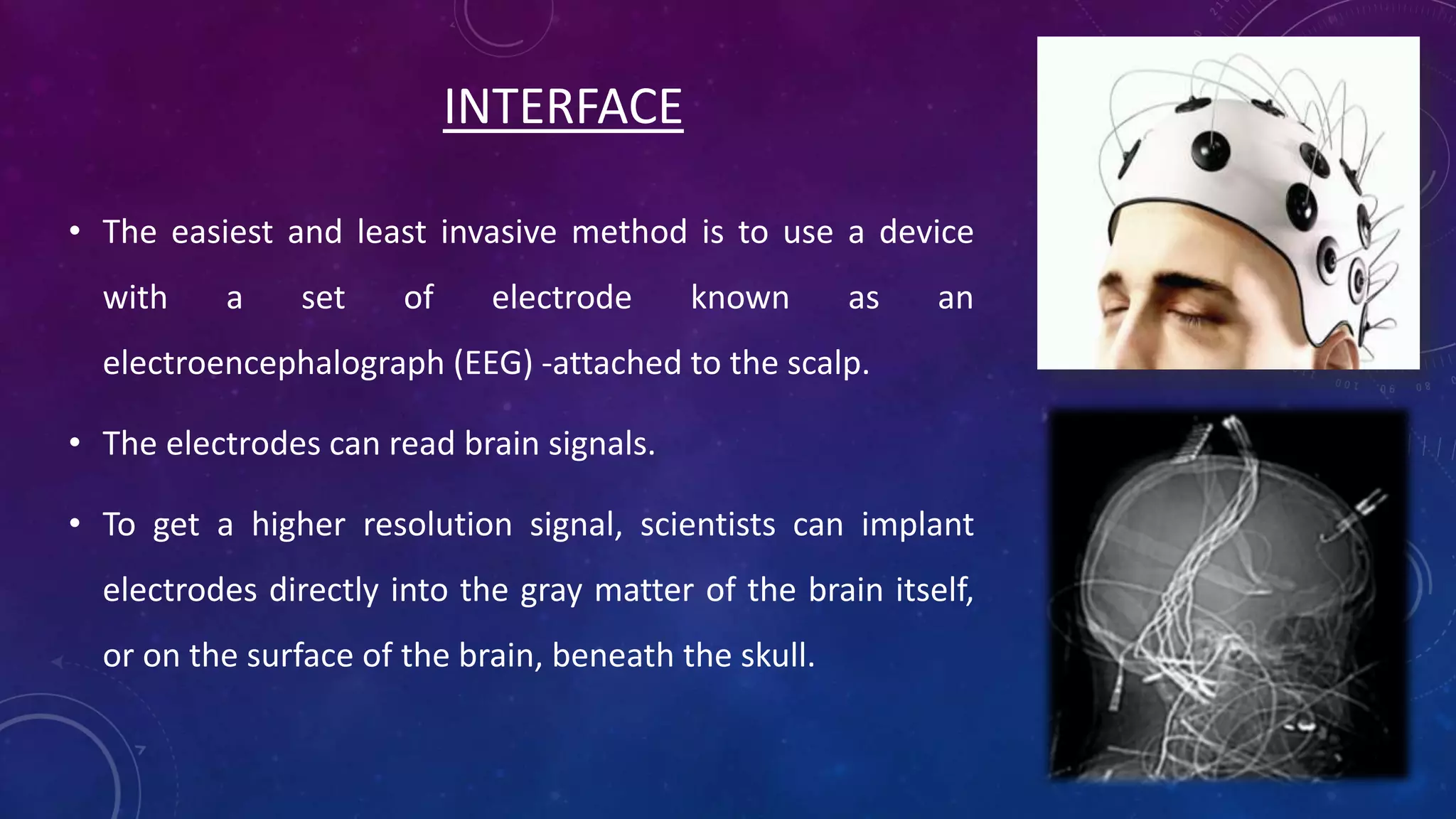 Brain chips ppt | PPTX
