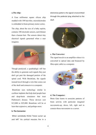 Brain chips | PDF