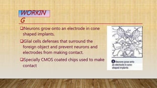 Brain chip technology | PPTX