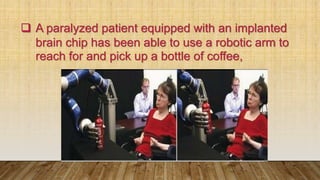 Brain chip technology | PPT