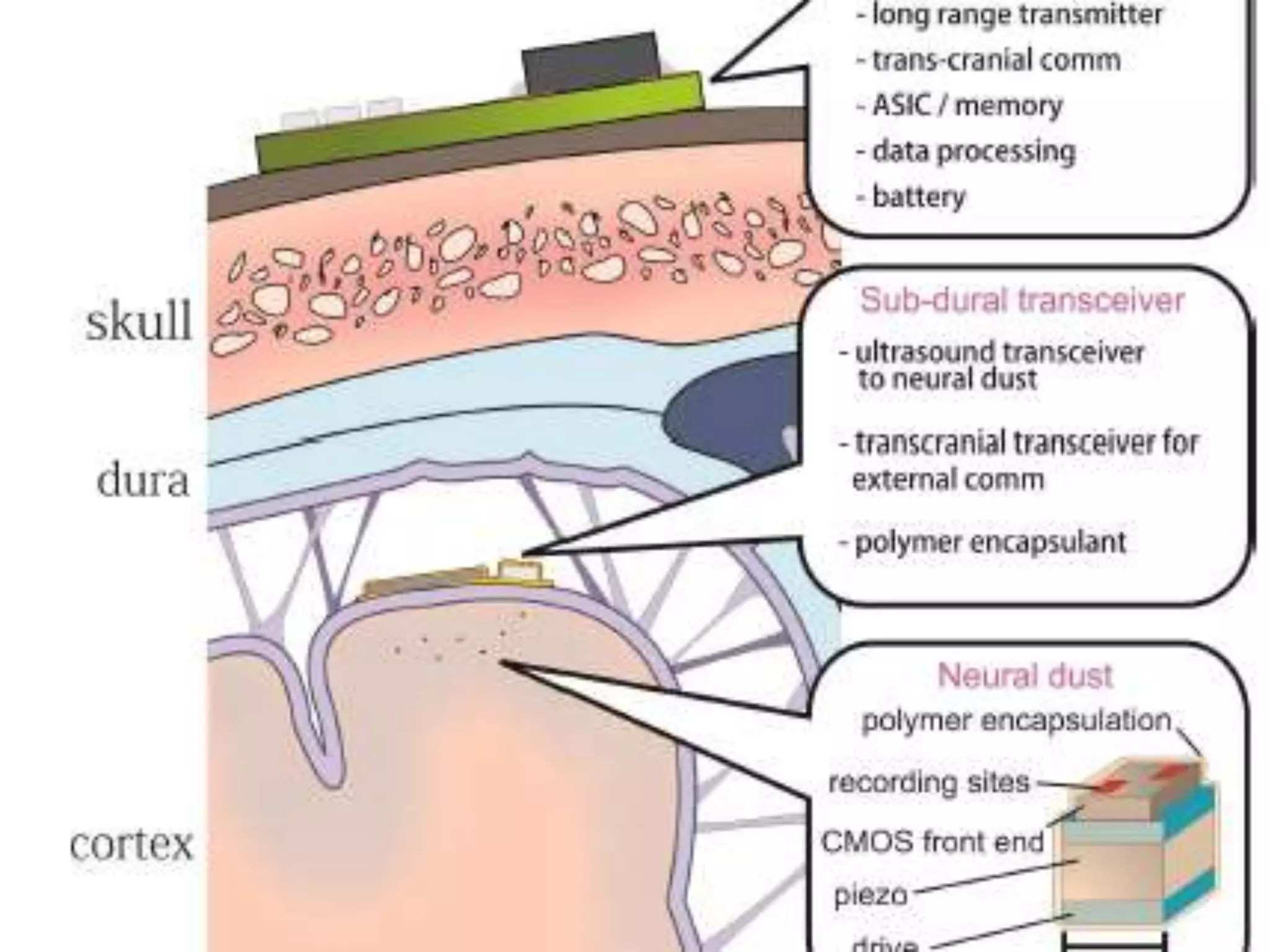 Brain chip technology | PPT