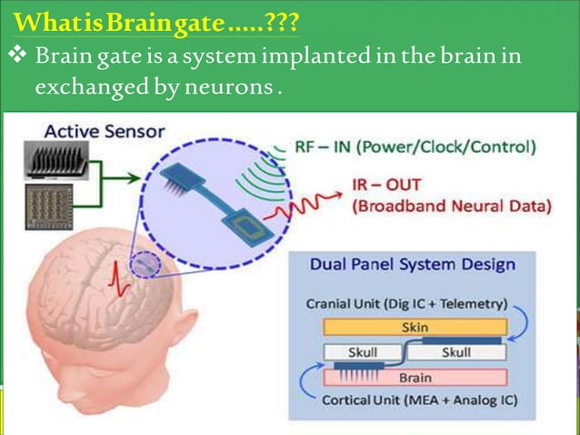 Brain chip technology | PPT