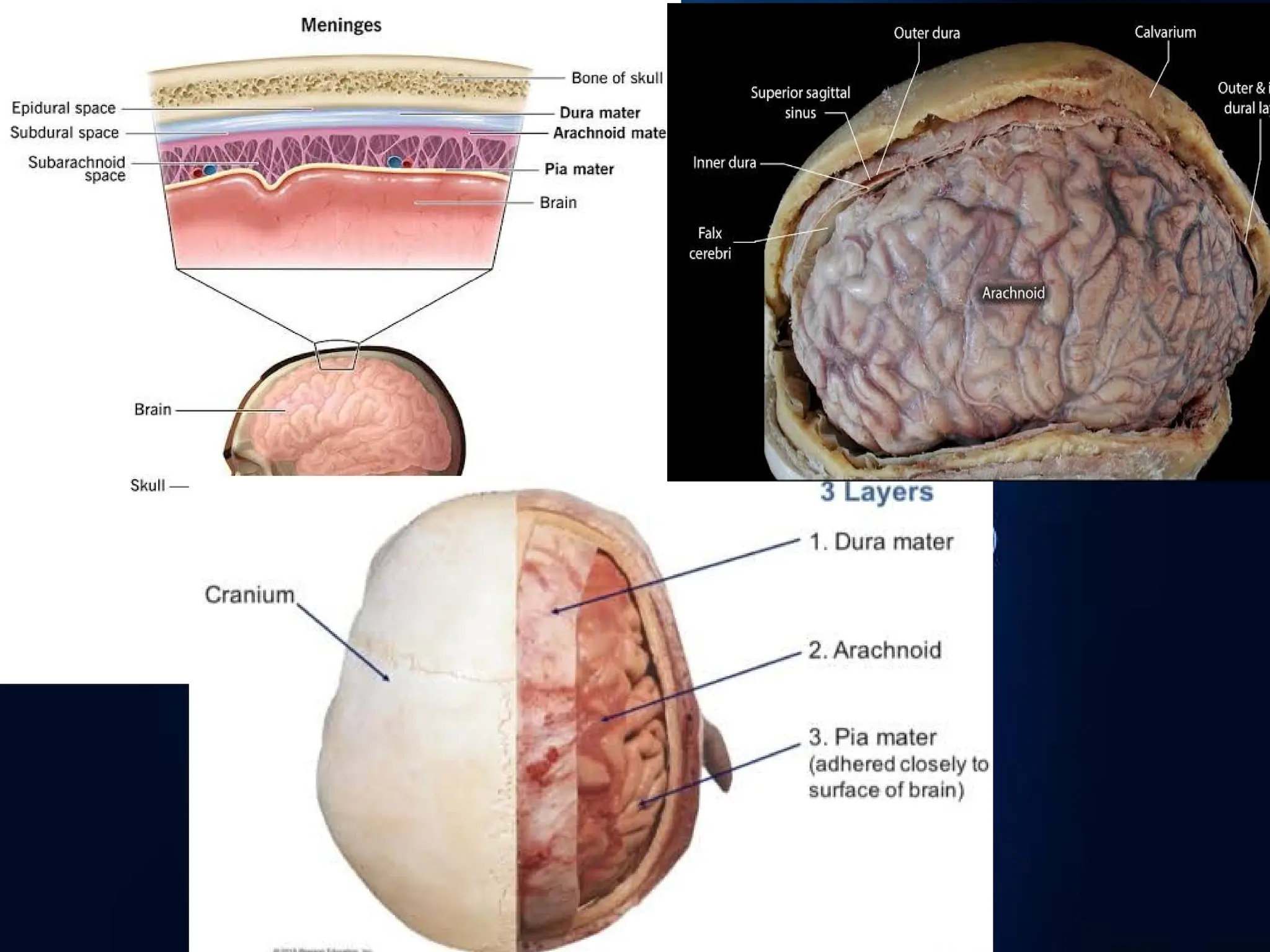 Brain Structure And Its Function Class 10 Pptx Brain And Nervous