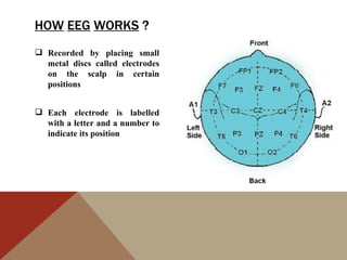 Brain computer interface | PPT