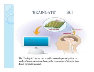 Brain computer interface | PPT