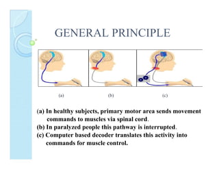 Brain computer interface | PPT