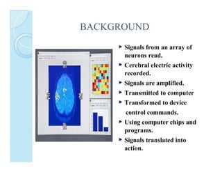 Brain computer interface | PPT