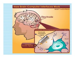 Brain computer interface | PPT