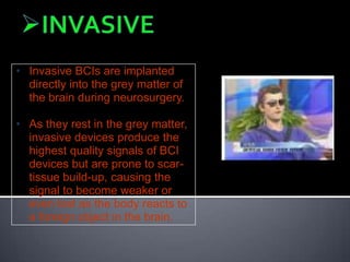 Brain computer interface | PPTX