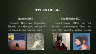 Brain computer interface | PPT