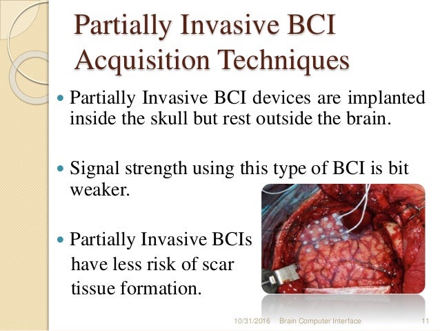 Brain computer interface
