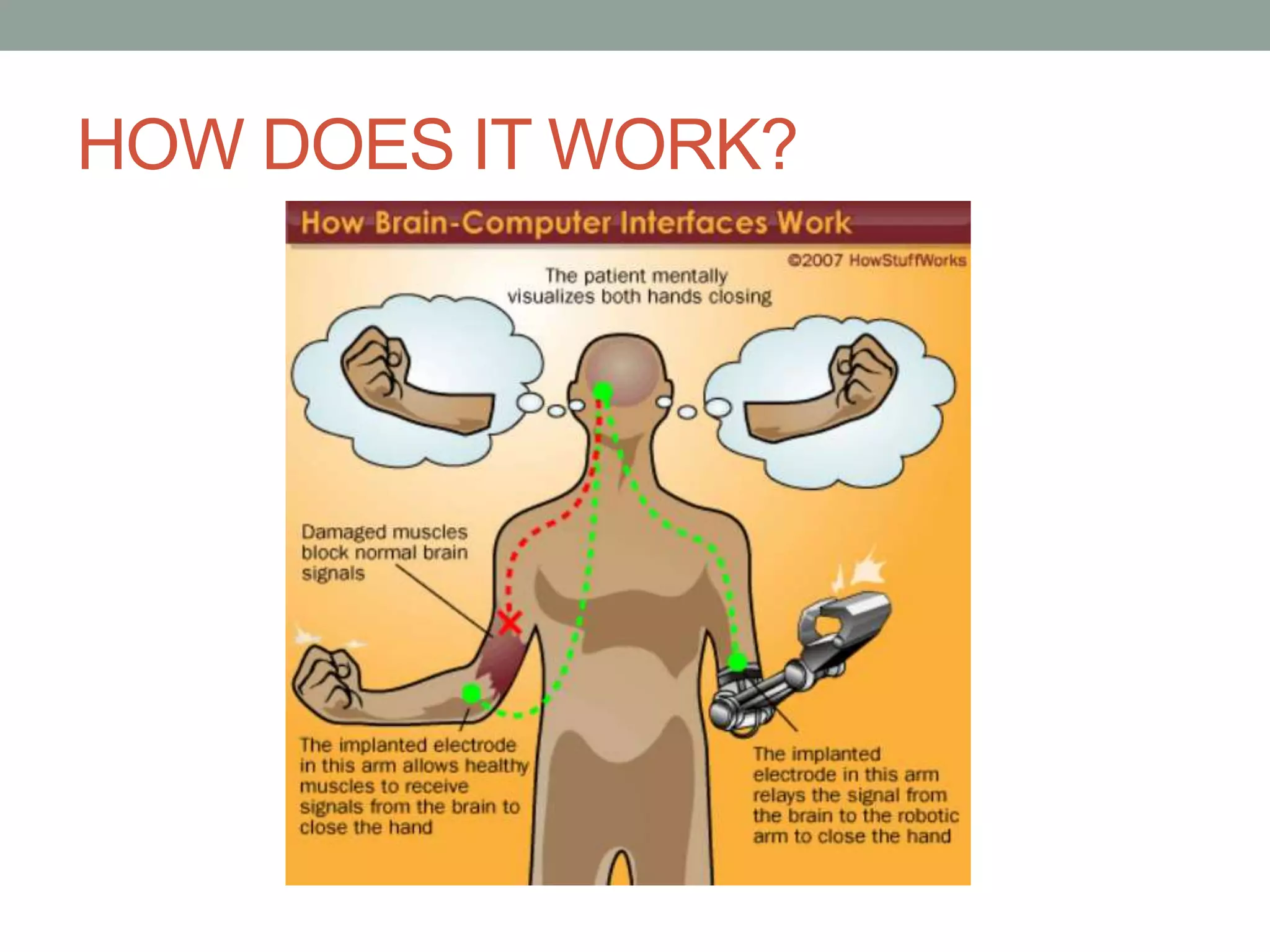 Brain computer interface (BCI) | PPTX | Brain and Nervous System ...