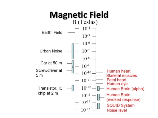 Brain computer interfaces
