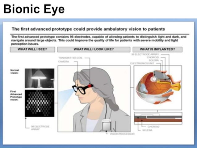 Brain Computer Interfaces(BCI) | PPTX