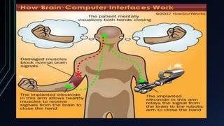 Brain computer interfacing | PPTX | Brain and Nervous System Disorders ...