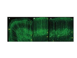 EEG signal background and real-time processing | PPTX