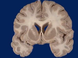 EEG signal background and real-time processing | PPTX