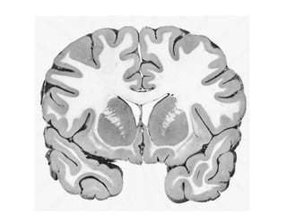 EEG signal background and real-time processing | PPTX