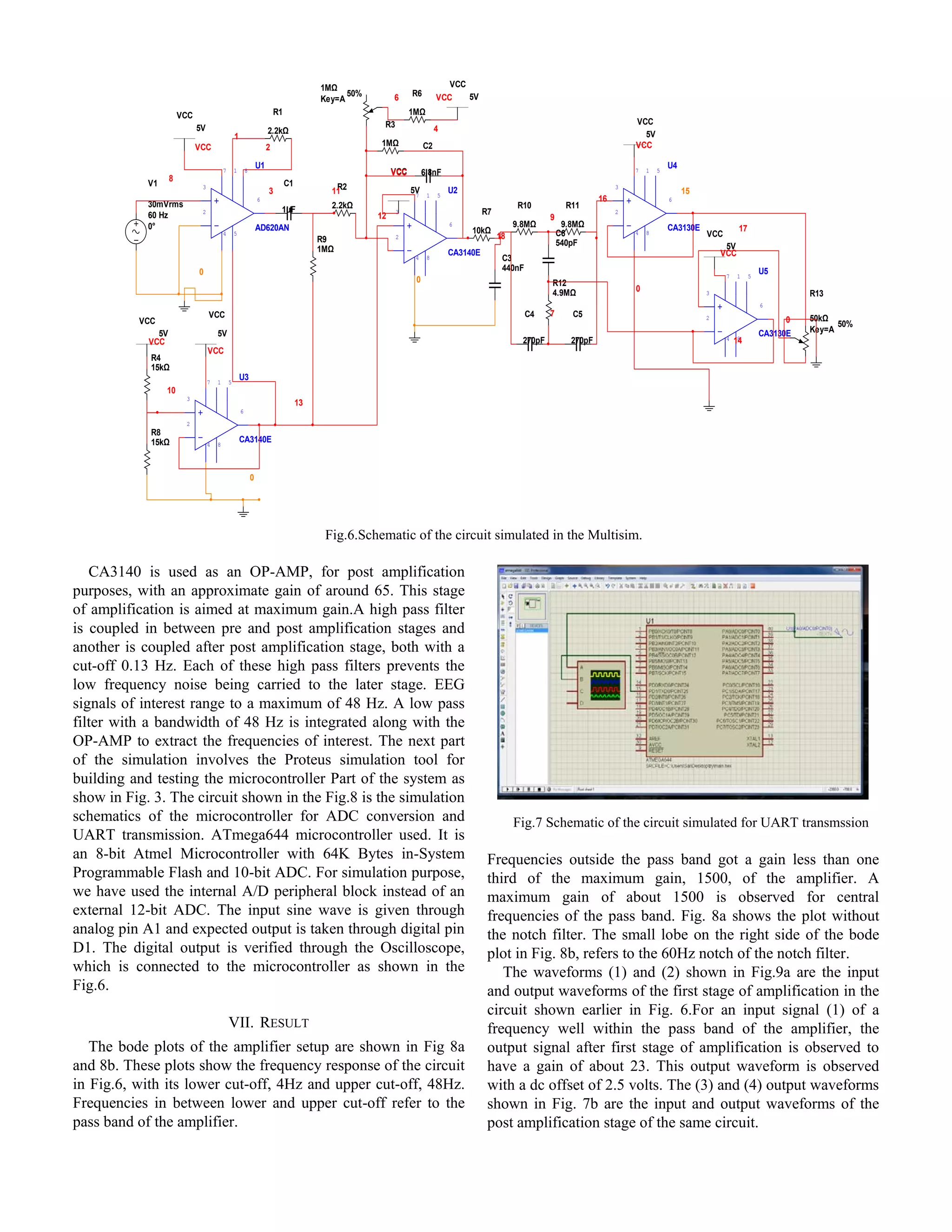 brain controled wheel chair.pdf | Computer Peripherals | Computing