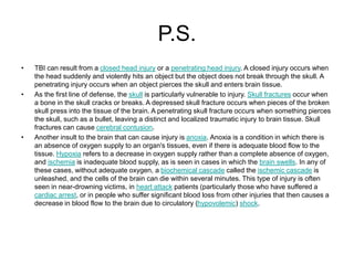 Brain Contusions.ppt.................... | PPT