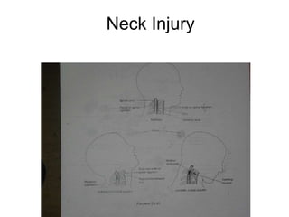 Brain Contusions.ppt.................... | PPT