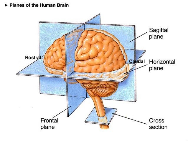Brain & Cranial Nerves