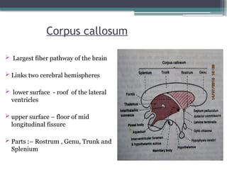 Brain Anatomy cross-sectional for radiology students | PPTX