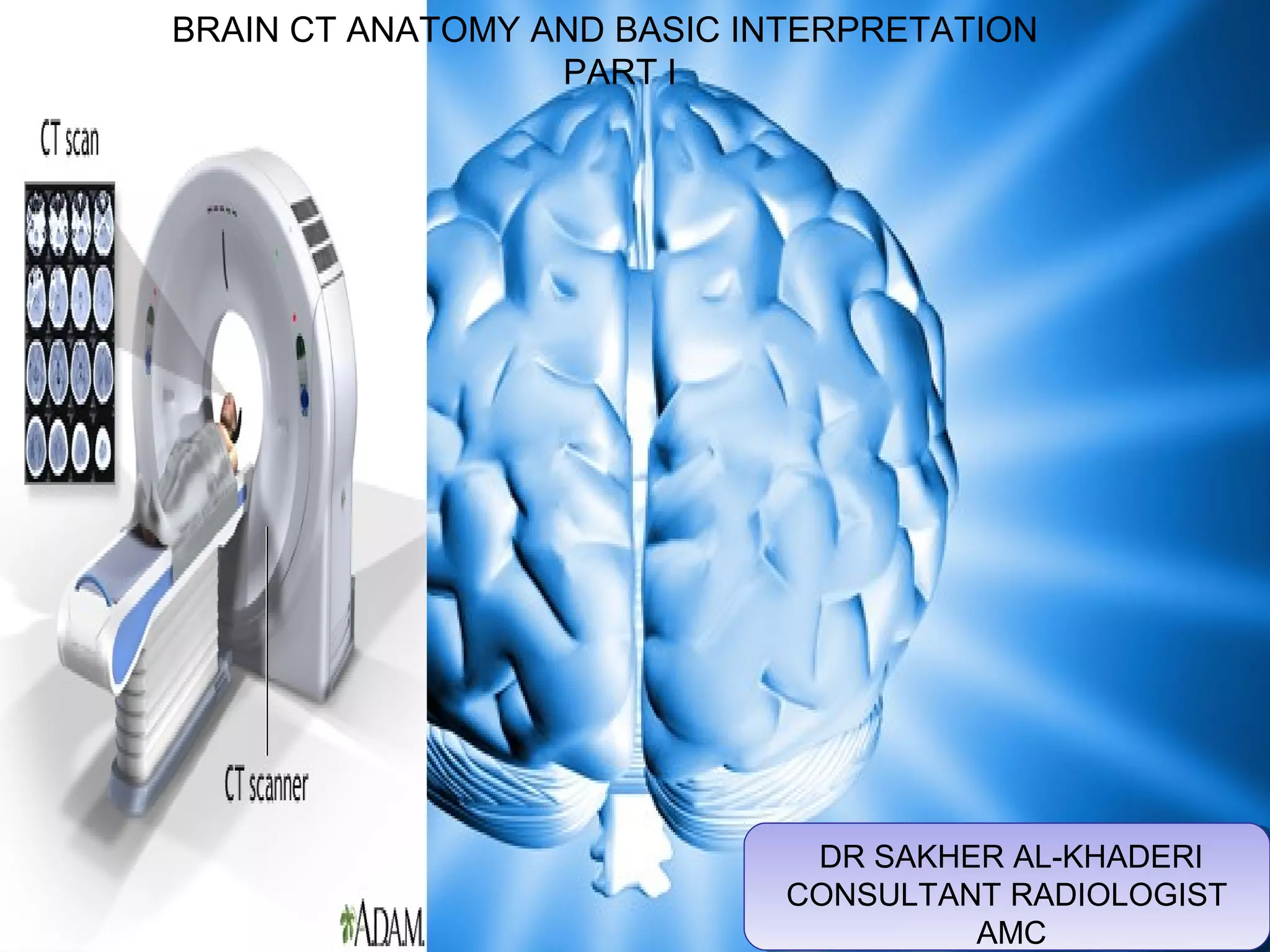 Brain CT Anatomy and Basic Interpretation Part I | PPT