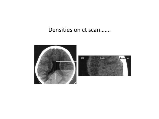 Brain Ct Anatomy And Basic Interpretation Part I Ppt
