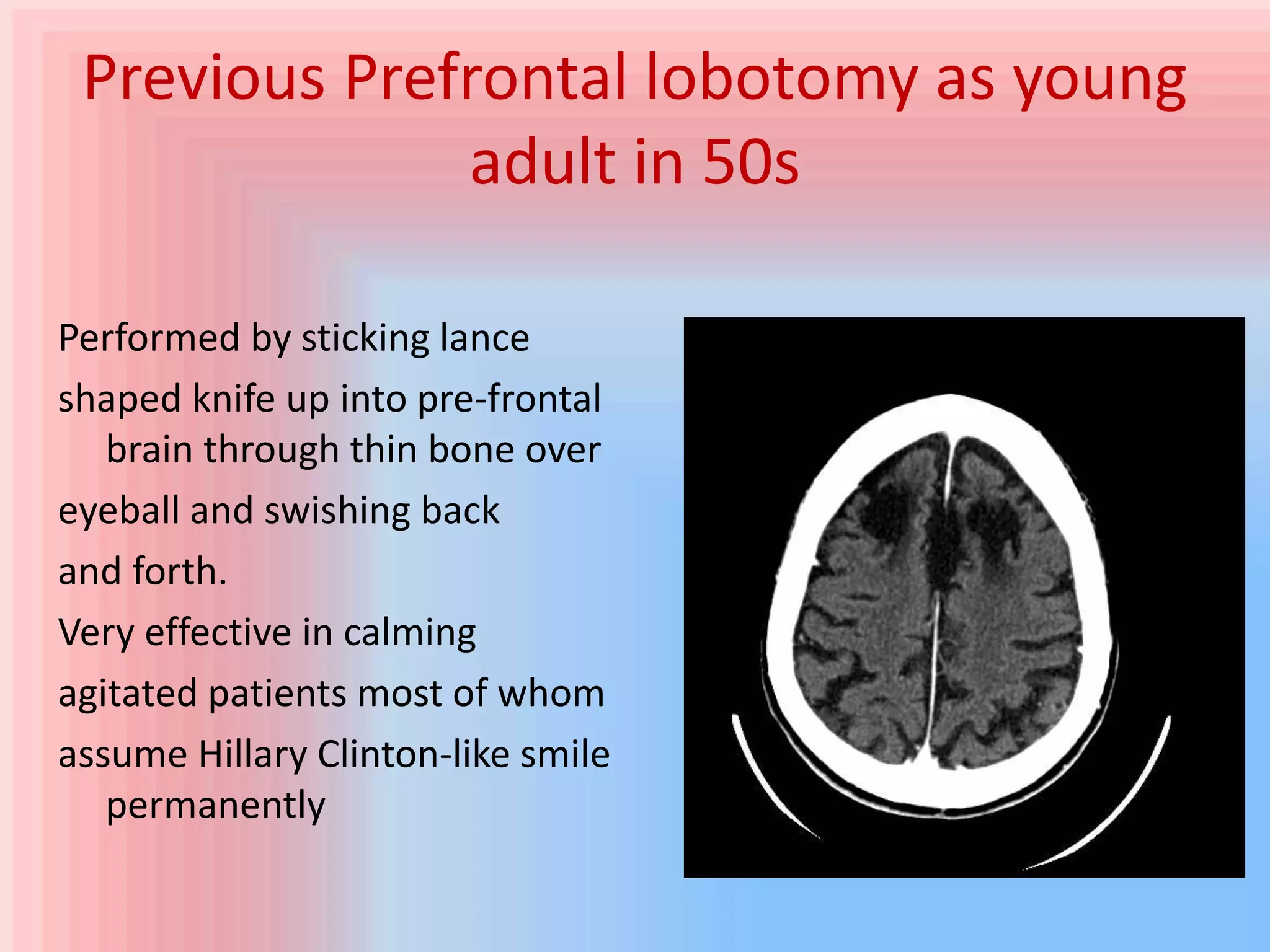 Brain ct and mri in icu | PPTX