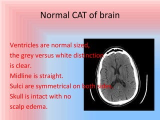 Brain ct and mri in icu | PPTX